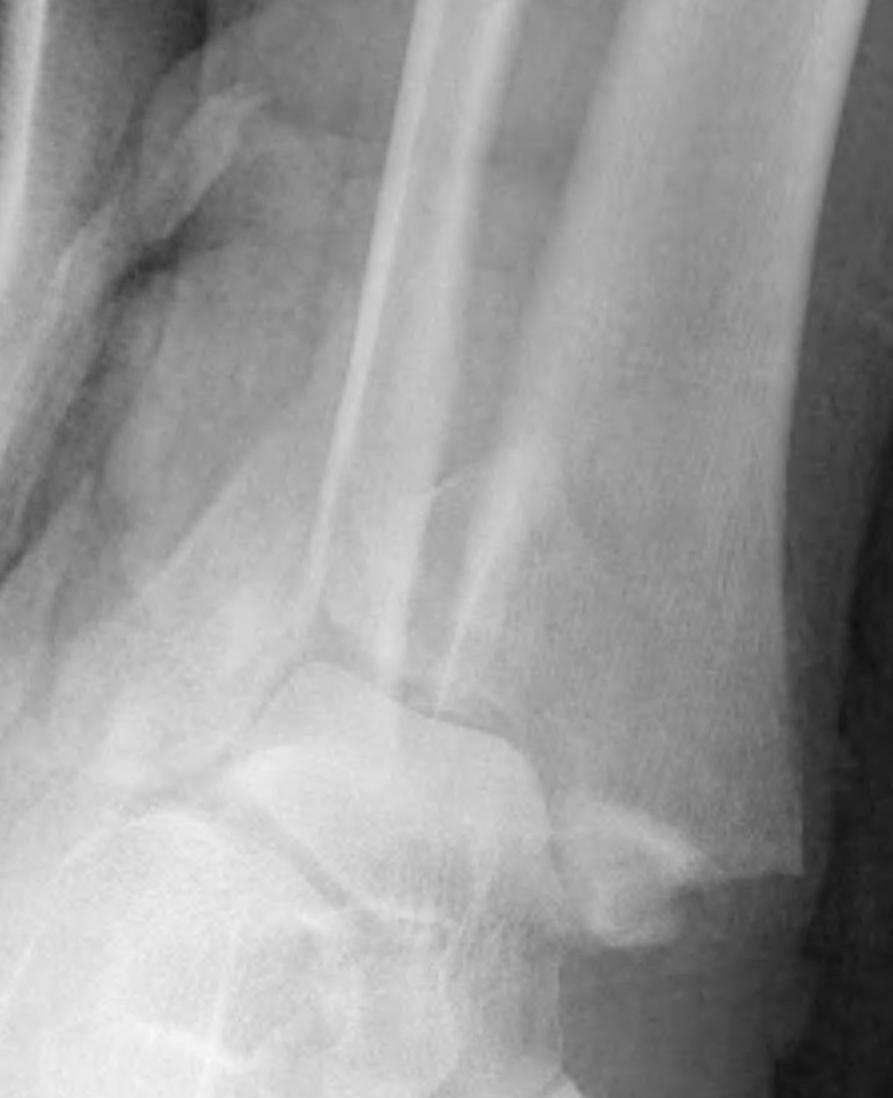 Background | The Bone School